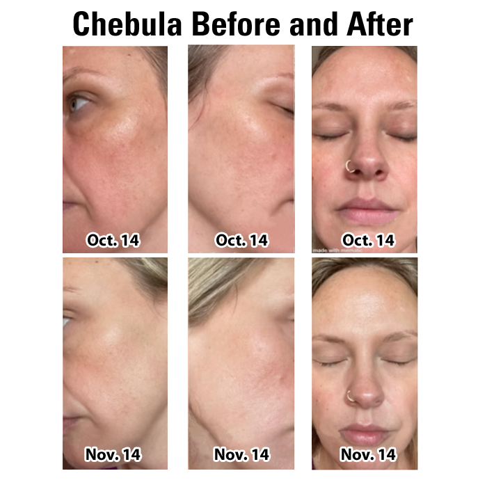 Tranexamic Depigmenting Serum. Gio Pelle Skincare